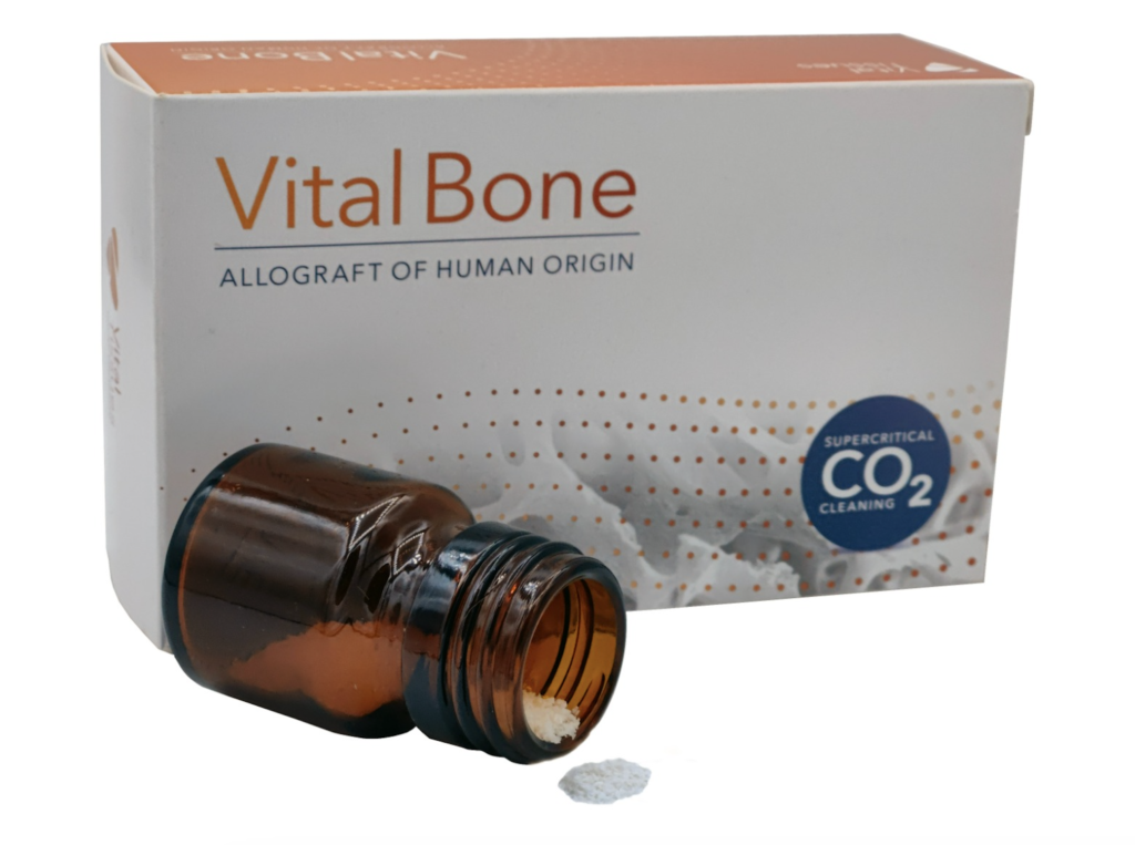 Vital Bone Cancellous Chips 1cc (0,25-1mm) - Vital Tissues