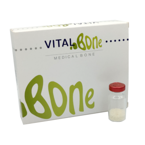 Bone Chips - Vital Tissues
